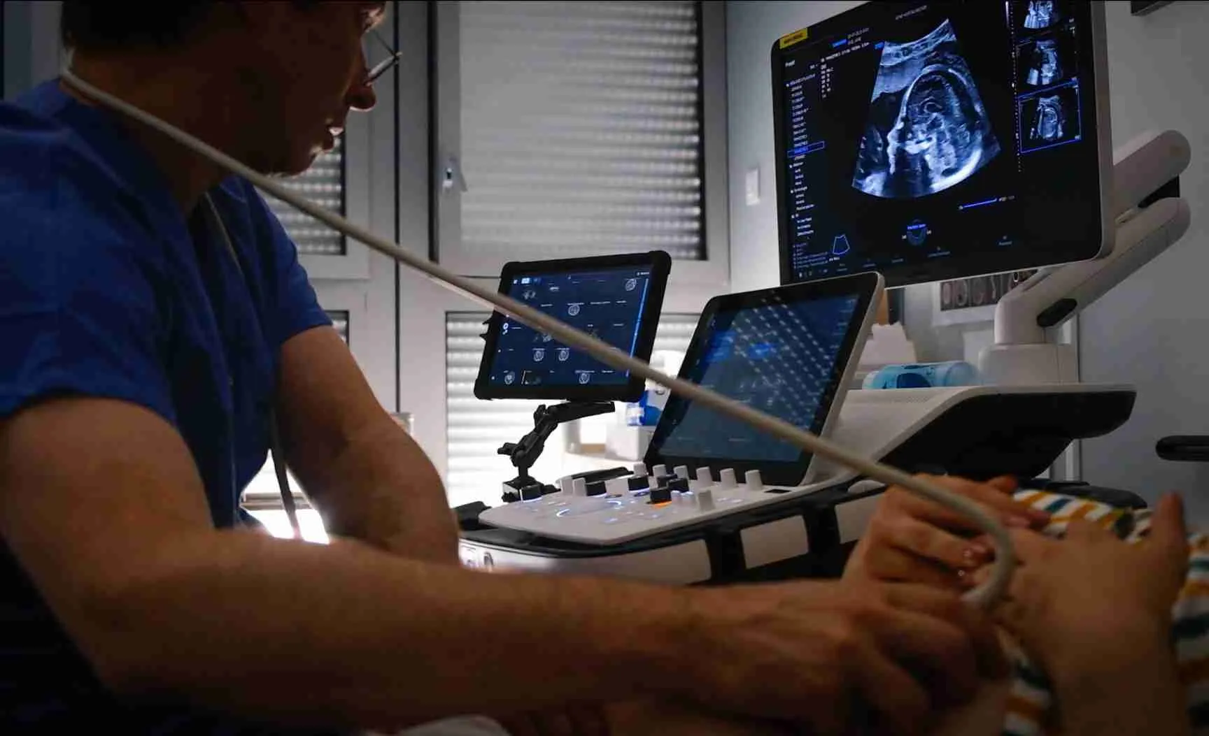 Understanding Sonographer Burnout: 7 Causes And Risk Factors