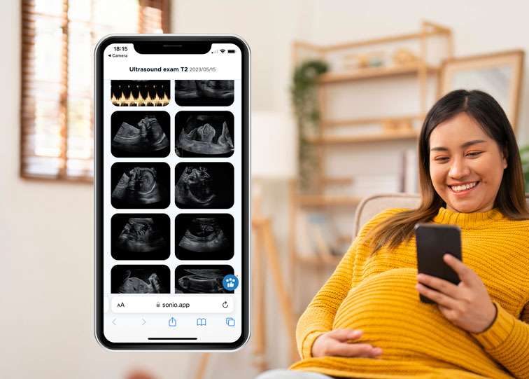 Designed To Streamline And Automate Prenatal Ultrasound Workflows | Sonio